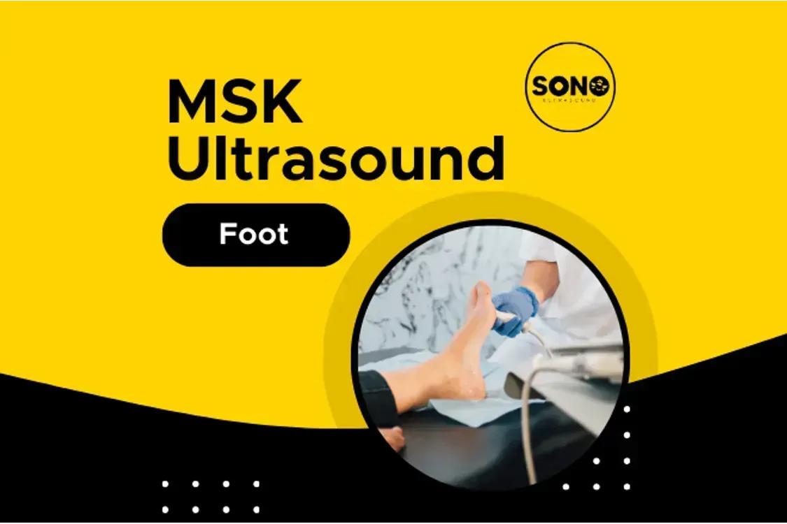 Foot MSK Scan | Musculoskeletal Ultrasound for Foot Pain & Injuries ...